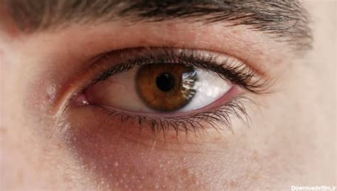 عکس چشم میشی رنگ