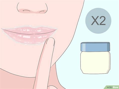 3 Formas De Curar A Queilite Angular Wikihow