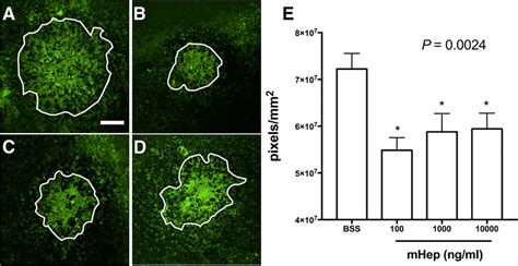 Choroidal Neovascularization Analyses After Intravitreous Injection Of Download Scientific
