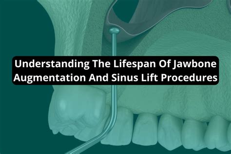 Understanding The Lifespan Of Jawbone Augmentation And Sinus Lift Procedures Advanced