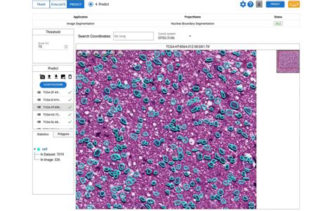 unveiling the hidden insights cell nuclei segmentation with deep learning
