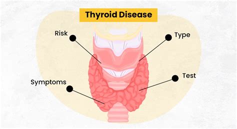Thyroid Disease Type Risk Symptoms And Diagnostic Tests