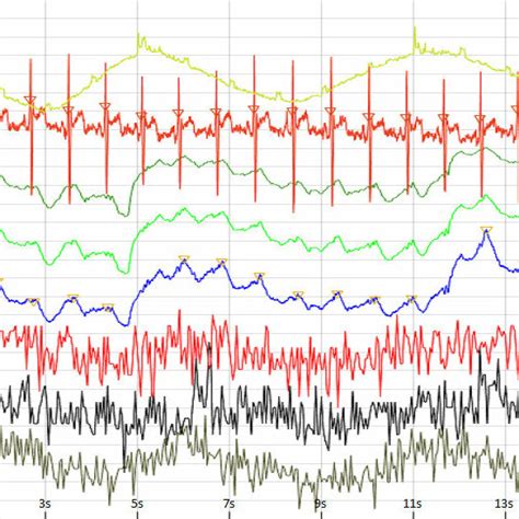 Raw Data Curves Measured With The Device In The Laboratory Testing