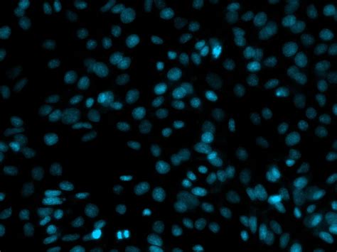 Clinical Microscopes From Zeiss Your Certified Microscopes For Your Clinical Lab