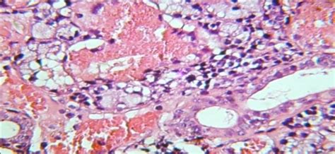 Histopathological Section In Thyroid Gland Of Rat In Chronic At 60 Day