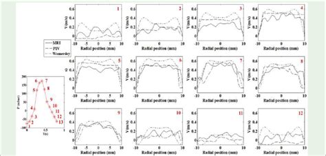 Comparison Of Experimental Results Mri And Piv Measurements With