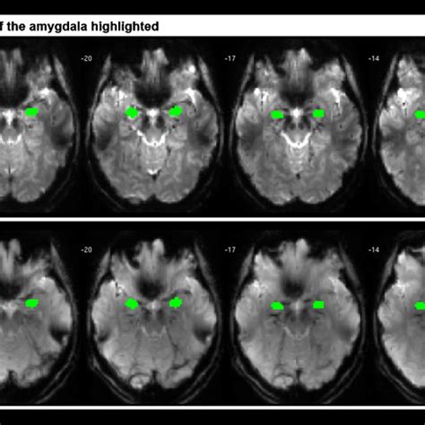 Fmri Group Analysis Of 7 T Dataset Second Level Group Analysis T Download Scientific Diagram