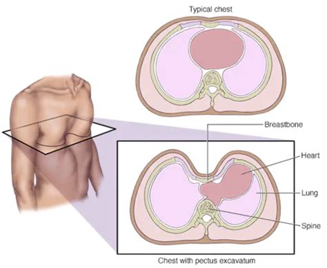 Thorax And Lung Assessment Flashcards Quizlet