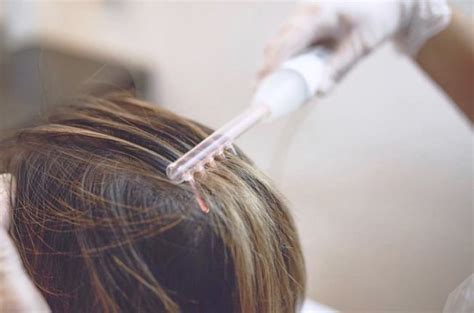 Cmoldent ¿qué Es La Alta Frecuencia Capilar La Alta