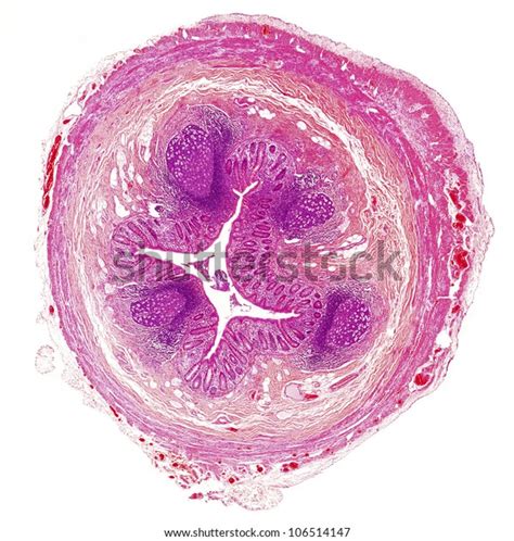 Microscope Picture Human Appendix Stock Photo 106514147 Shutterstock