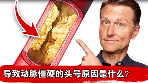 导致动脉僵硬的头号原因是什么？ 知乎