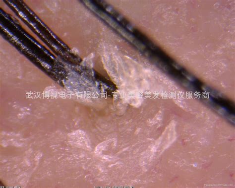 500x Scalp Bacteria Scope（2 0m Pixels） Cbs 605 Cbs China Manufacturer Personal Care