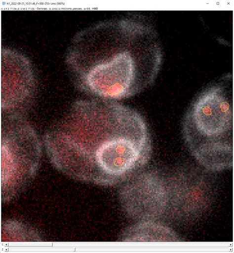 stardist for spots image analysis image sc forum