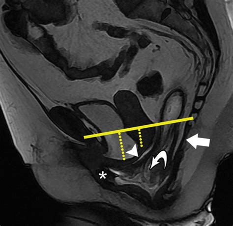 Mr Imagingbased Assessment Of The Female Pelvic Floor Radiographics