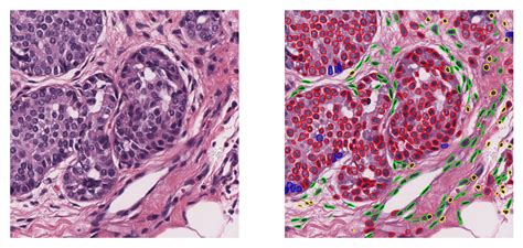 Nucleus Instance Segmentation Tia Toolbox 151 Documentation