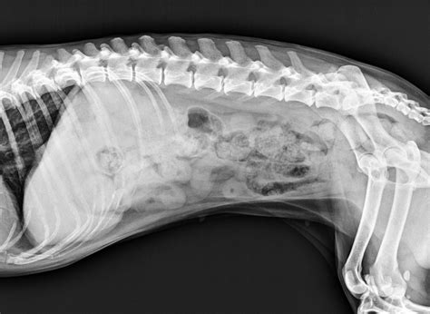 Ab04 2 Object Detection Dataset By Organdetection