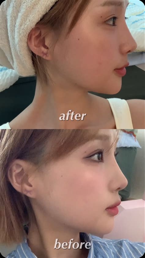 김세령 광고 이번에 새롭게 리뉴얼 되어 나온과채소의 피부 정화 기능을 그대로 ‘슈퍼 베지톡스 클렌저 그린은 민간성 피부 자극 테스트 완료 제품으로 여드름 케어에