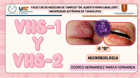 Virus De Herpes Simple Tipo 1 Y 2 Mafhy Osorio Udocz