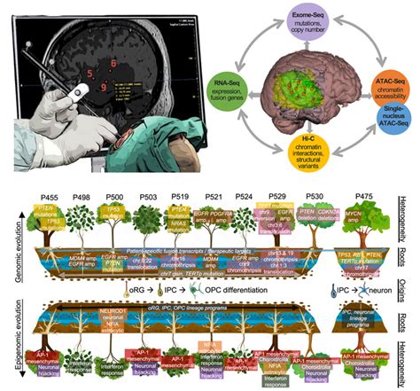 Cell：从三维全肿瘤角度揭示胶质母细胞瘤的进化和异质性 生物科技 健康一线资讯