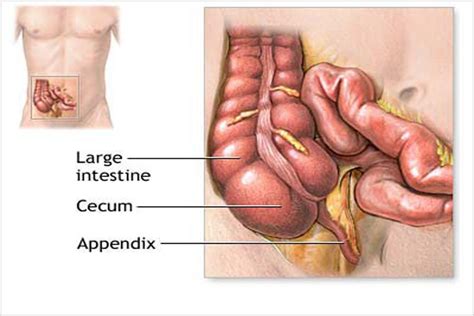 Appendix Removal Cost