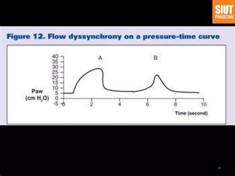 Ventilator Waveforms PPTX