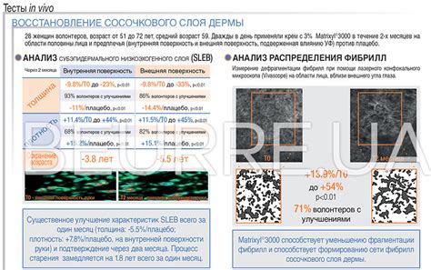 Matrixyl 3000 - купить в BEURRE l Украина