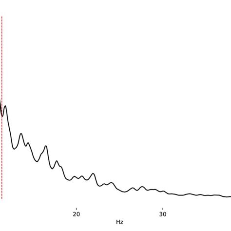 Spectral Segmentation Of Ictal Eeg Into 5 Modes Download Scientific