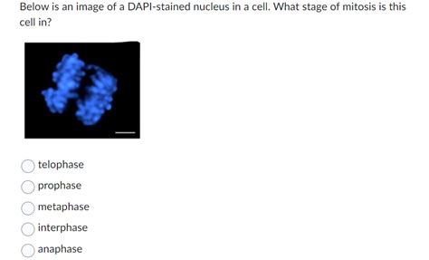 Solved Below Is An Image Of A Dapi Stained Nucleus In A