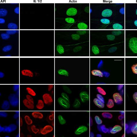Nuclear F Actin Localization Relative To Rcs Lifeact Gfp Nls
