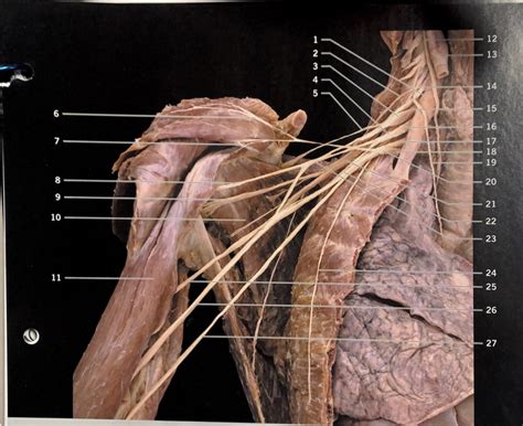 Brachial Plexus Cadaver Diagram Quizlet