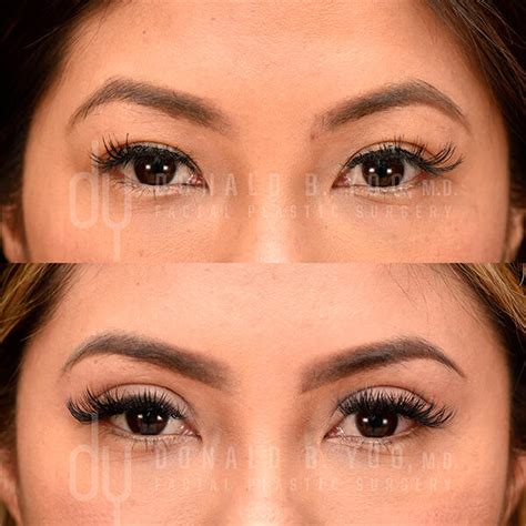 Eye Makeup For Asian Double Eyelids Saubhaya Makeup