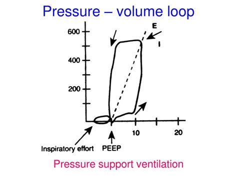 Ppt Interpretation Of Ventilator Graphics Powerpoint Presentation