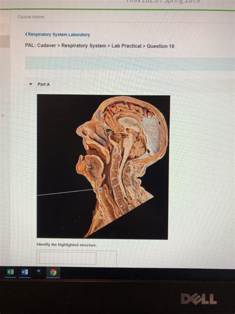 Solved Course Home Respiratory System >Lab Practical | Chegg.com