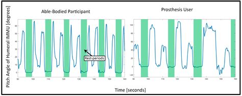 Testing The Use Of Advanced Upper Limb Prostheses Towards Quantifying