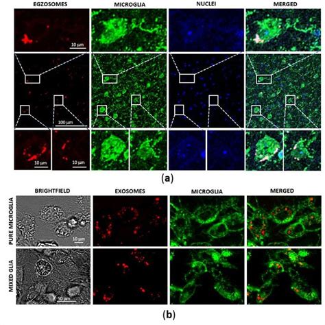 Poly I C Treated Airway Cell Exosome Internalisation By Microglia In