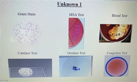 Staphylococcus Aureus Catalase Test