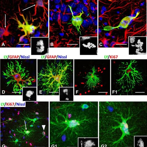Electron Microscopy Of Astrocytes In Arrested Mitoses A Condensed Download Scientific Diagram