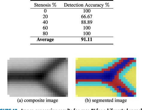 figure 12 from a quadruple sweep bioimpedance sensing method for