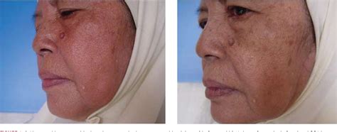 Carbon Dioxide Content Measurement Semantic Scholar