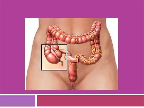 11asuhankeppadapasienappendicitisppt