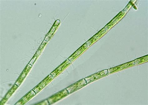 Morphology Of Oedogonium With Diagram Algae