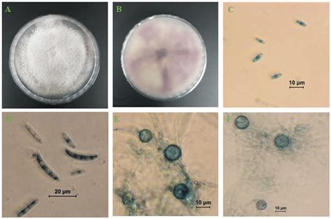 A Bayesian Inference Phylogenetic Tree Based On Combined Its Lsu Download Scientific Diagram