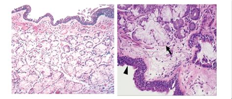Path Pft Obstructive And Restrictive Lung Disease Flashcards Quizlet