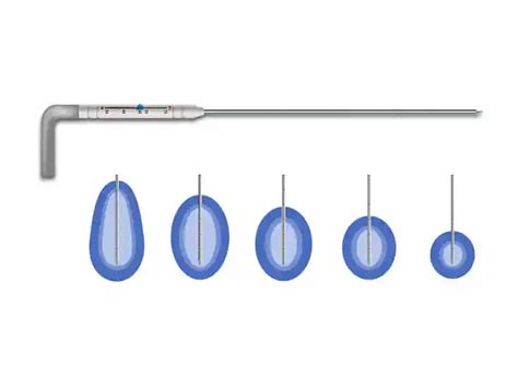 cryocare probes and accessories