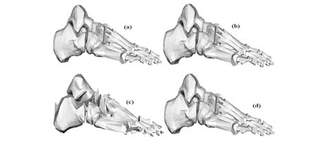 Compression Results For The Object Bones A Of The Basic Algorithm