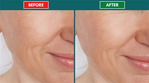 Diode Charismaticaclinic Diode Charismaticaclinic