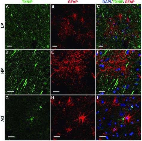 Confocal Microscopy Showing Limited Colocalization Of Txnip With Download Scientific Diagram