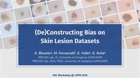 [ppt] De Constructing Bias On Skin Lesion Datasets A Bissoto M Powerpoint Presentation