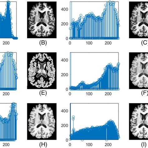 Segmentation Results Of The Mri Brain Tissues Ab Original Brain