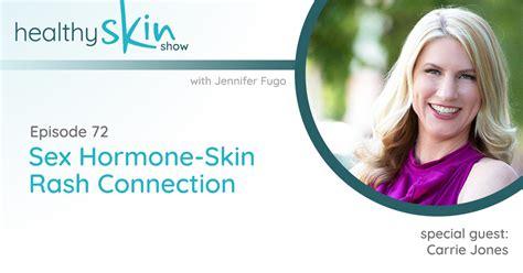 072 Sex Hormone Skin Rash Connection W Dr Carrie Jones